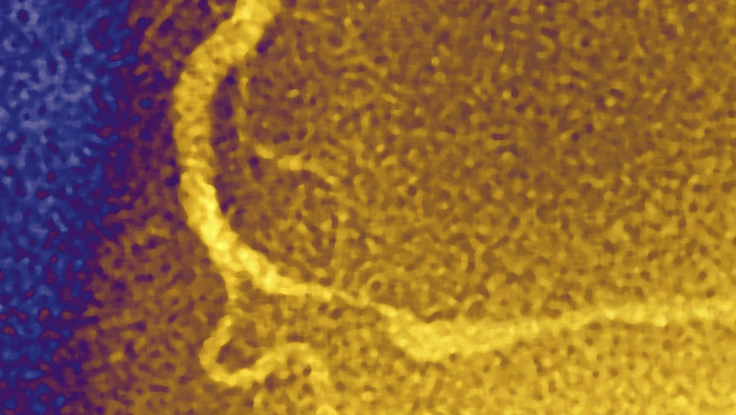 Manganese shows promise in reversing artery plaques in mice