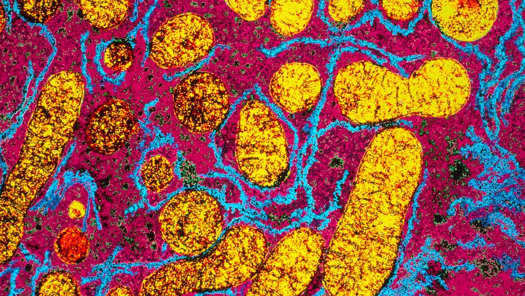Scientists uncover how mitochondria pause protein production to aid ...