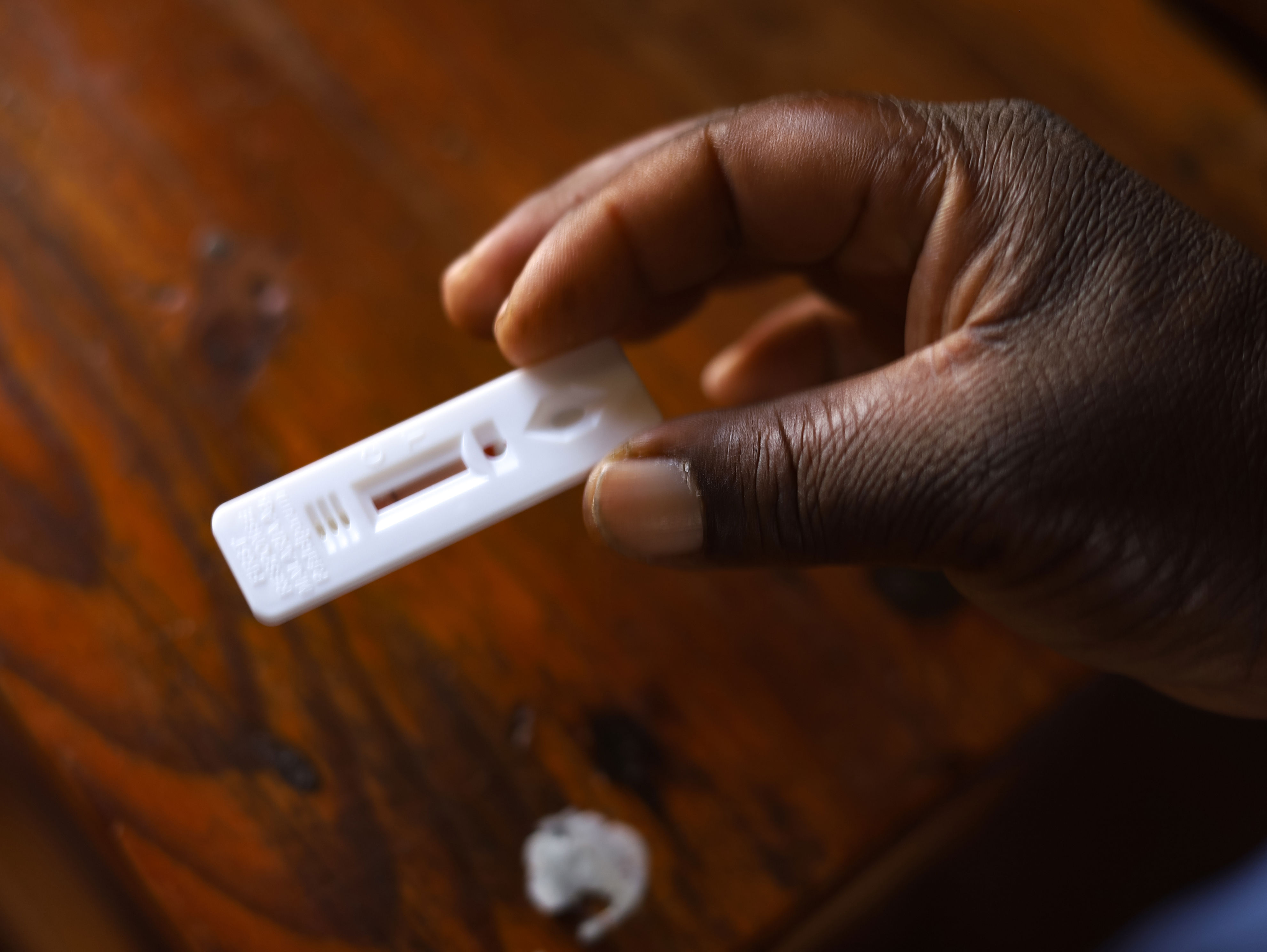 Aid cuts and climate change drive deadly malaria surge in Zimbabwe