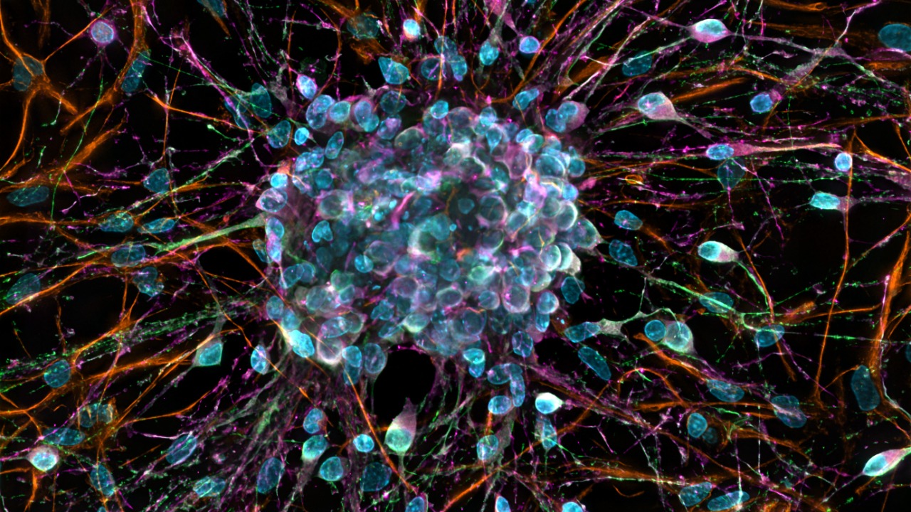 Cambridge researchers just wired a lab-grown brain into a spinal cord ...