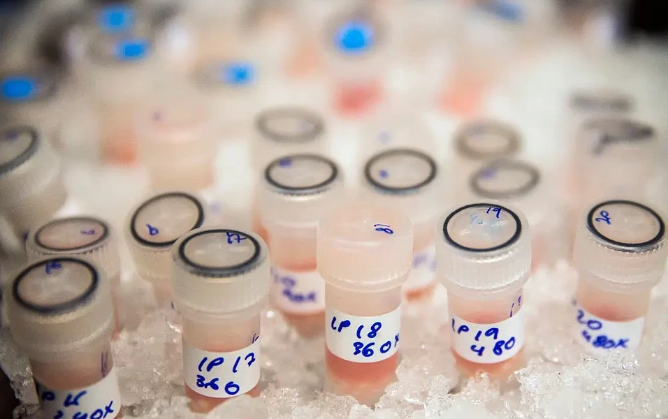 Gene test could spare thousands of breast cancer patients chemotherapy