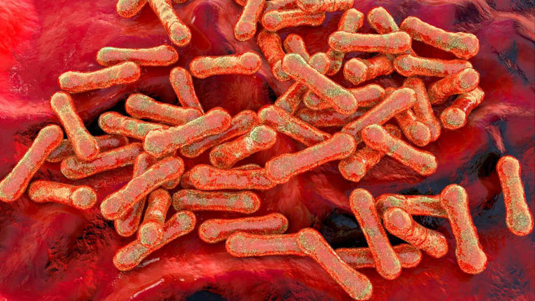 Travel warning issued to Brits over highly contagious 'bull-neck' virus ...
