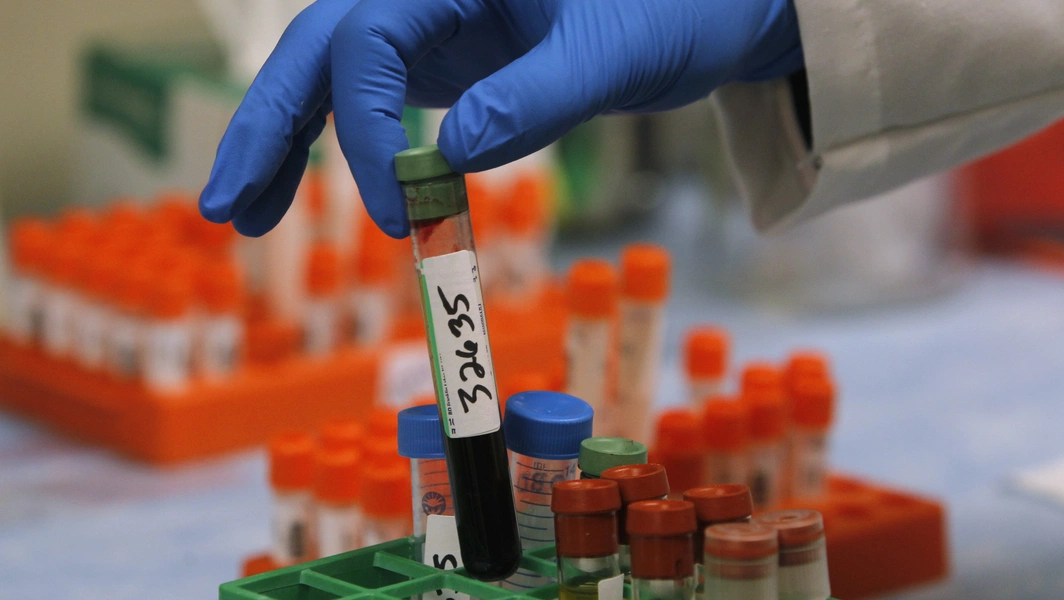 Gene test could spare thousands of breast cancer patients chemotherapy