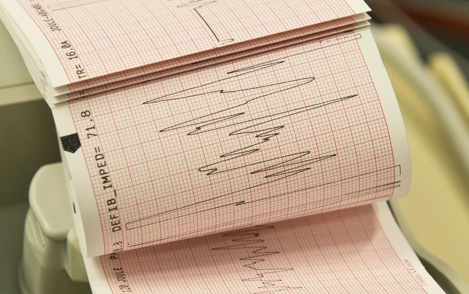 ECG-based index offers new way to track child development