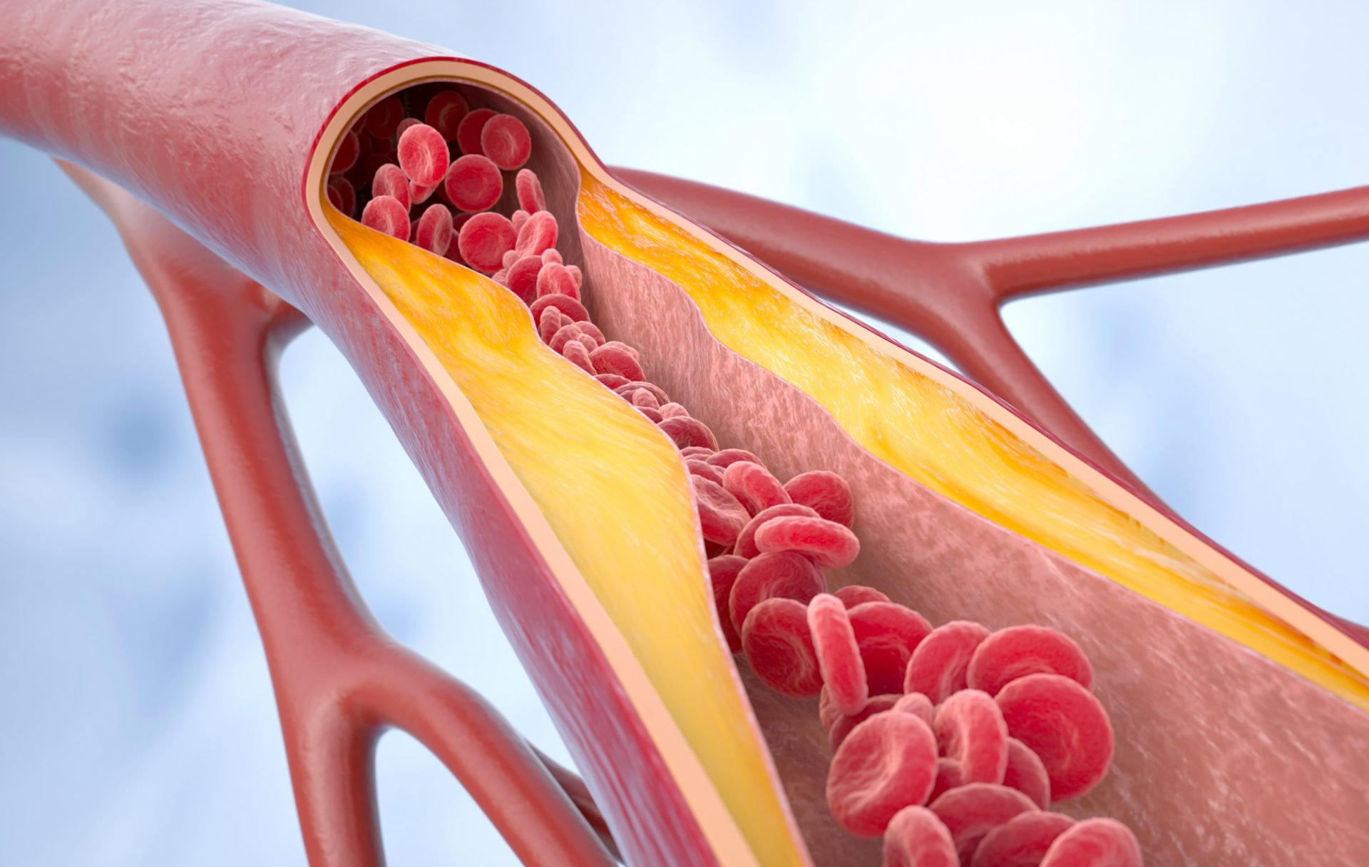 Why people in their 30s might need to start taking statins