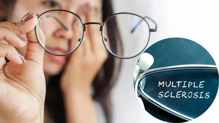 Blurred vision can be the first sign of multiple sclerosis - here's ...