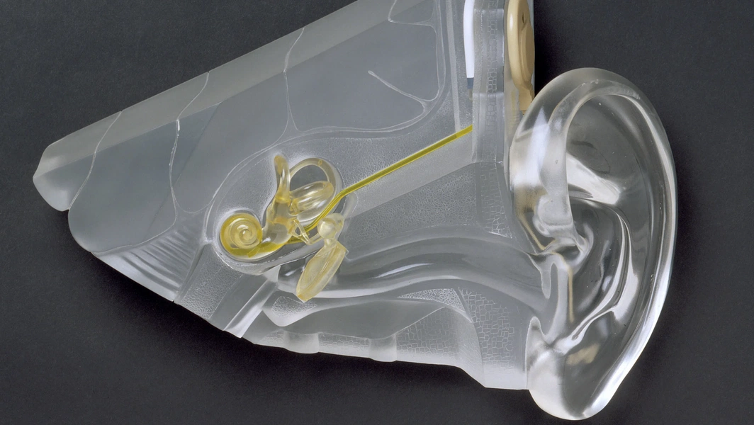 Cochlear shares seen rebounding modestly after steep fall