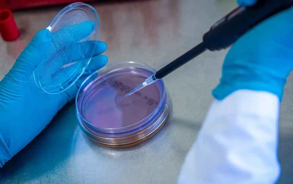 E coli’s double life from friend to foe