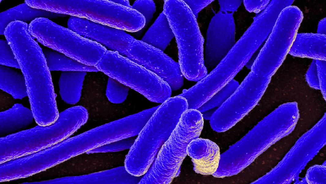 E coli’s double life from friend to foe