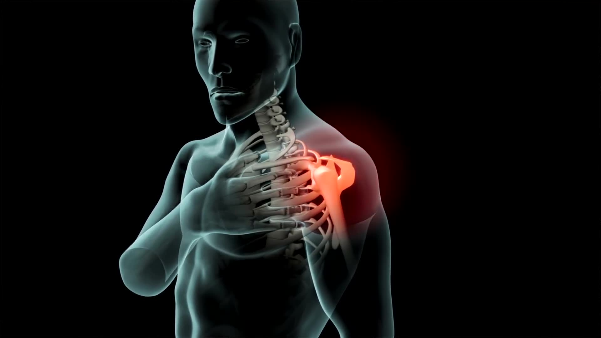 Orthopedic surgeons share what they tell patients about shoulder ...