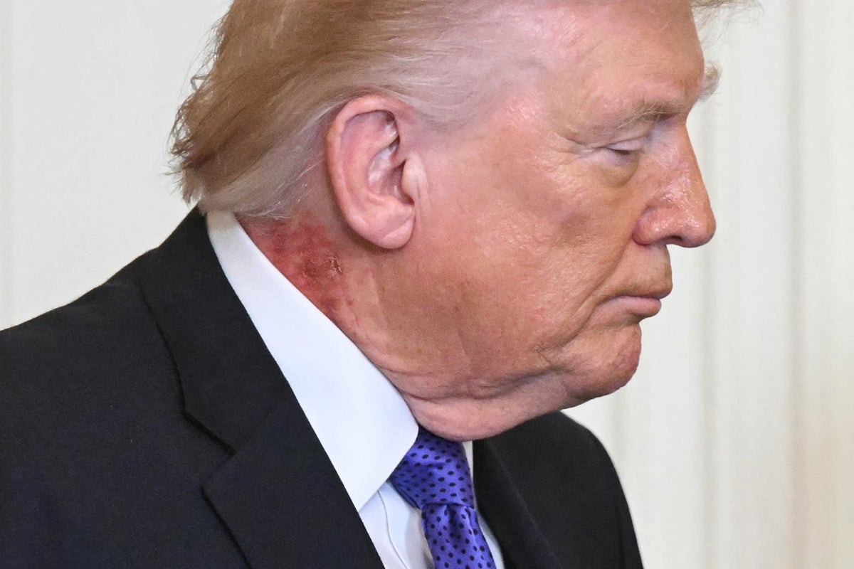 Trump’s latest health report says he needs to lose weight