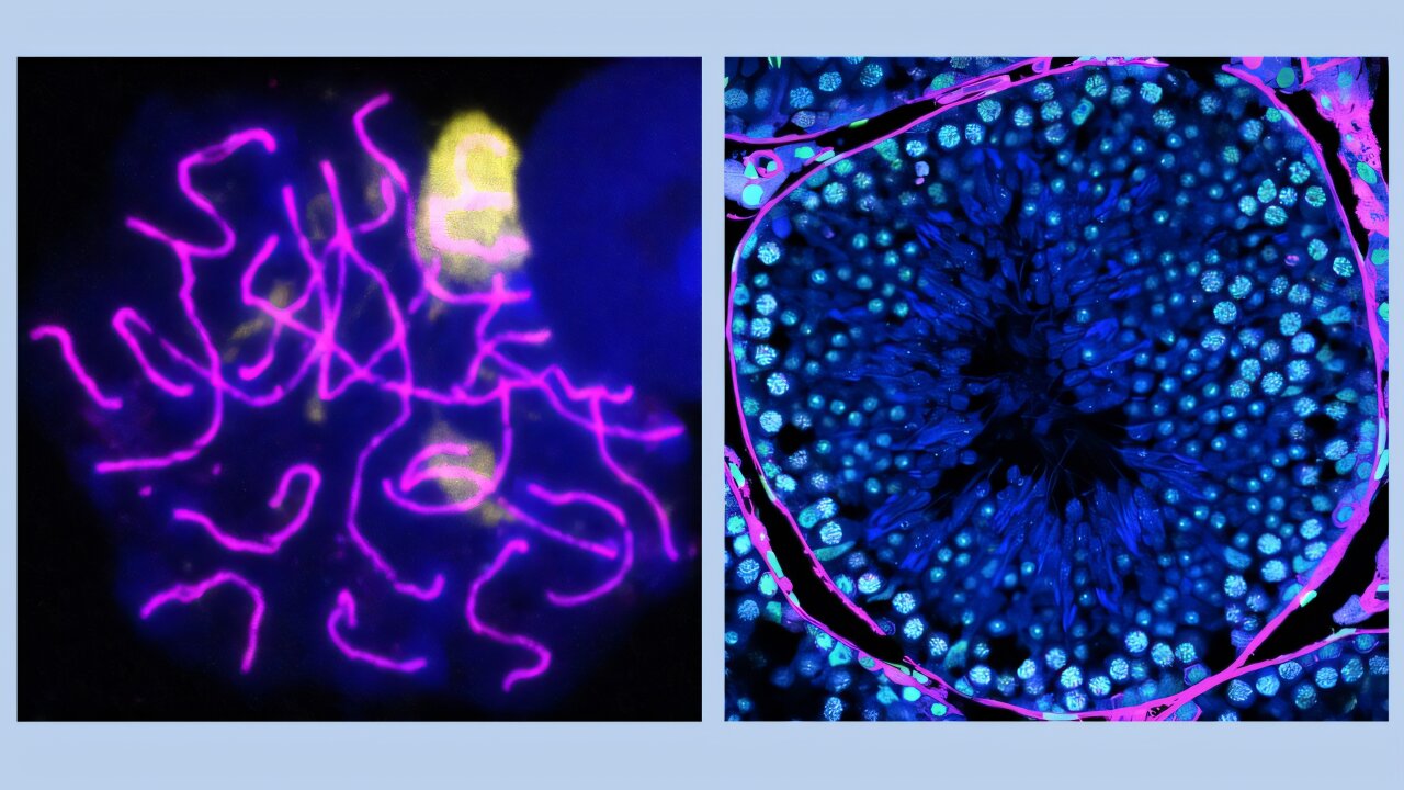 An overlooked protein may decide how fast male fertility starts to ...