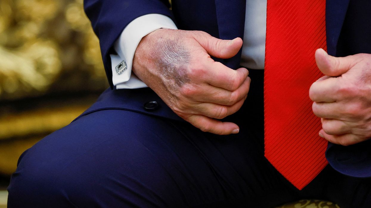 Social media unloads on ailing Trump's 'excellent health' claim