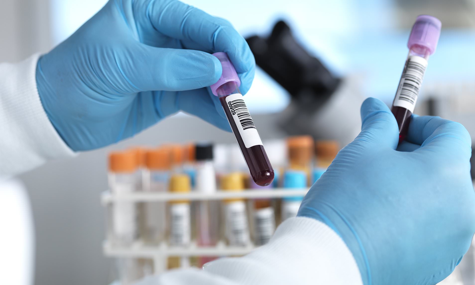 'Holy Grail' blood test could prevent one in five cancer deaths, saving ...