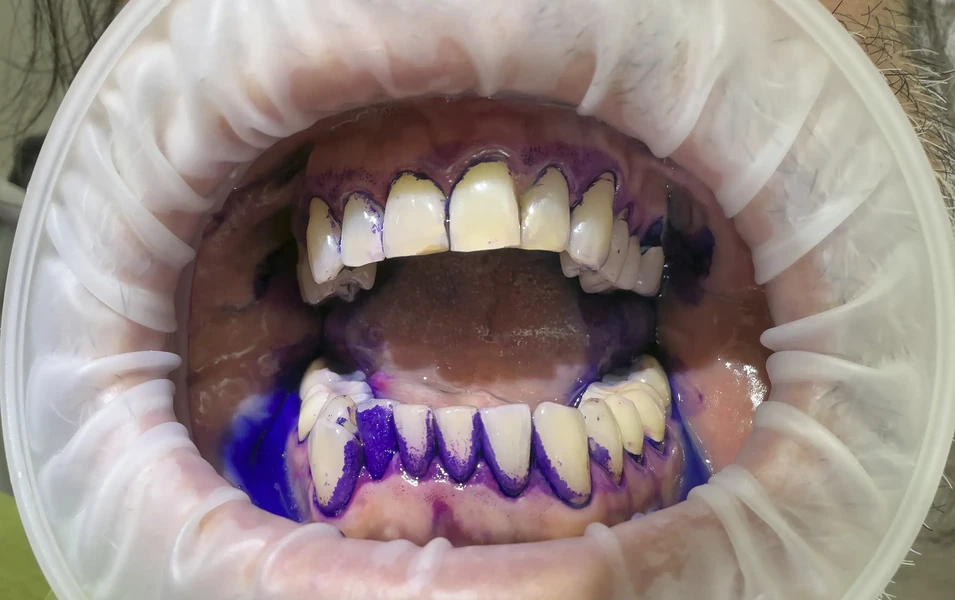 Why your gums might be the key to your health