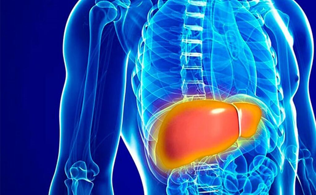 Hígado graso: ¿qué alimentos comunes pueden acelerar su daño?; conoce ...