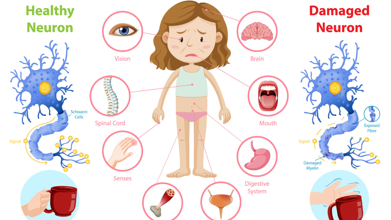 World Multiple Sclerosis Day: 10-point declaration calls for ...