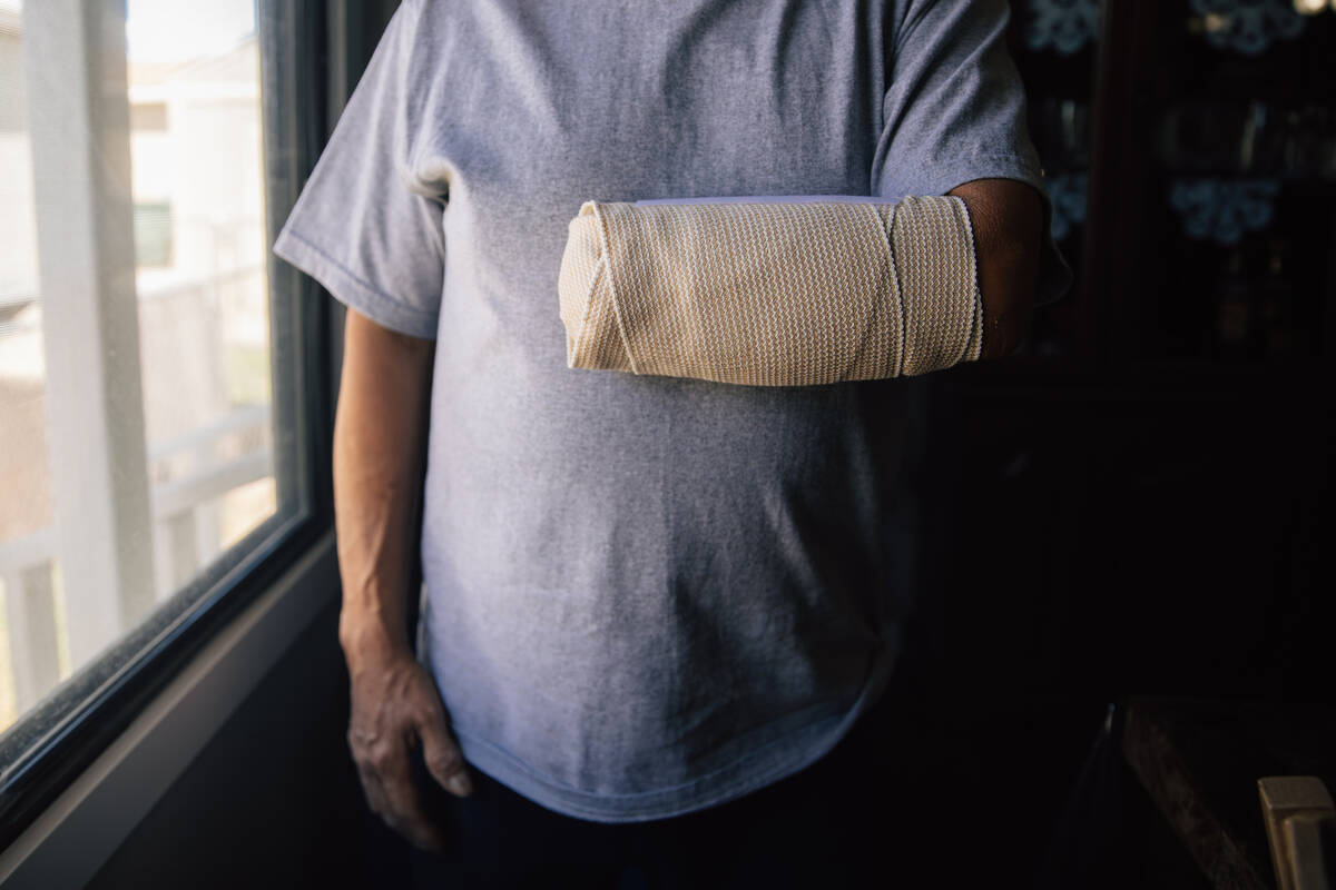 Man copes with loss of hand after Las Vegas crash involving suspected ...