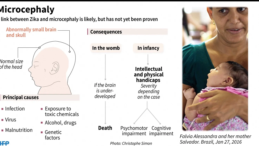 14 rare and unusual causes of death