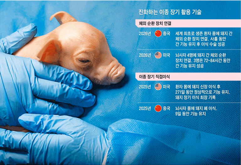 Chinese team transplants pig liver, kidneys in first multiple organ surgery