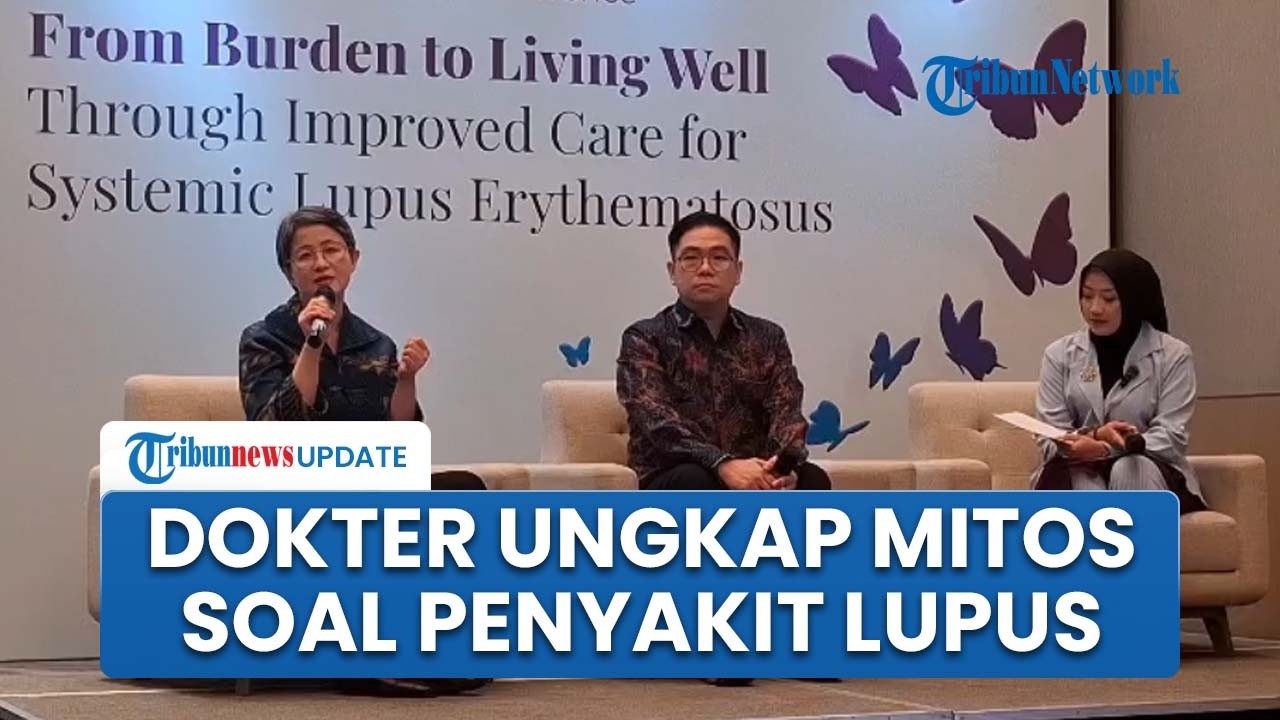 Fakta lupus yang jarang diketahui: Jangan percaya mitos, dokter ungkap ...