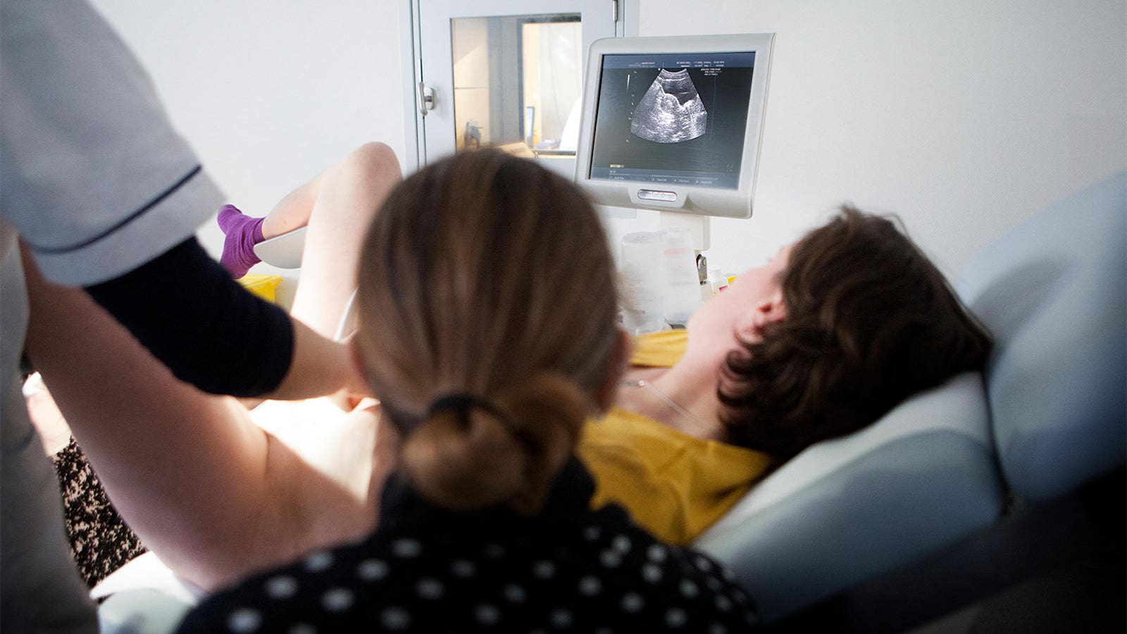 Endometrial cancer survivors face harder path to IVF success