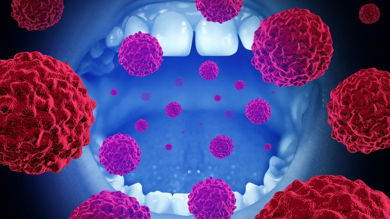 World No Tobacco Day: Oral cancer rising among non-smokers too, warns ...