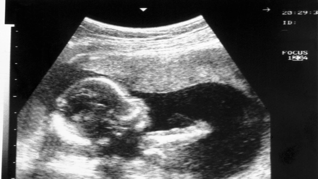 How music and voices shape your baby’s brain