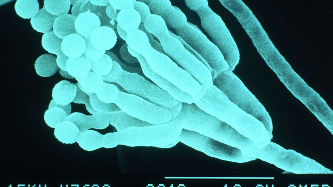 Scientists explore fungi to turn Martian soil into farmland