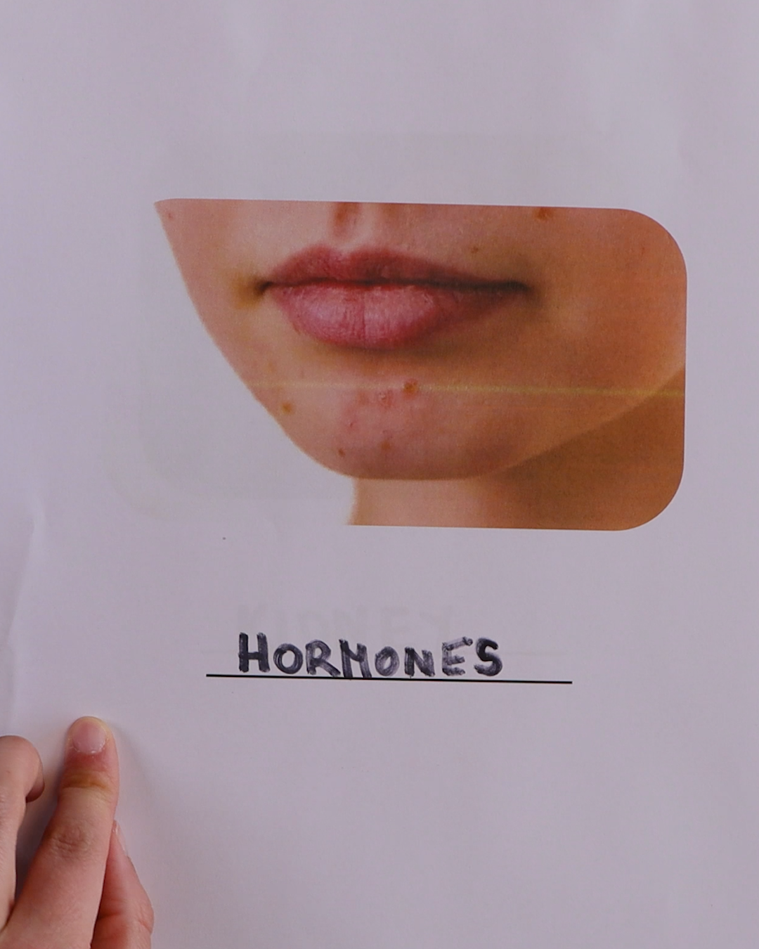 Your face blemishes can reveal health issues