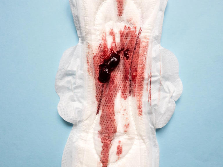 What to know about blood clots during your period