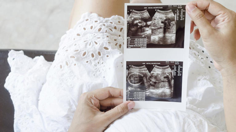 Woman’s agonising 5-year wait for diagnosis