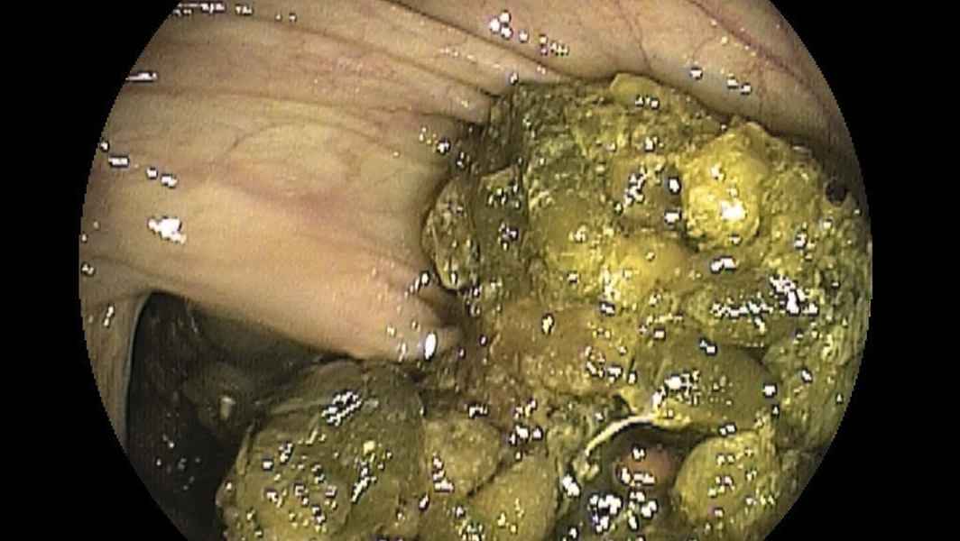 What your poop says about you