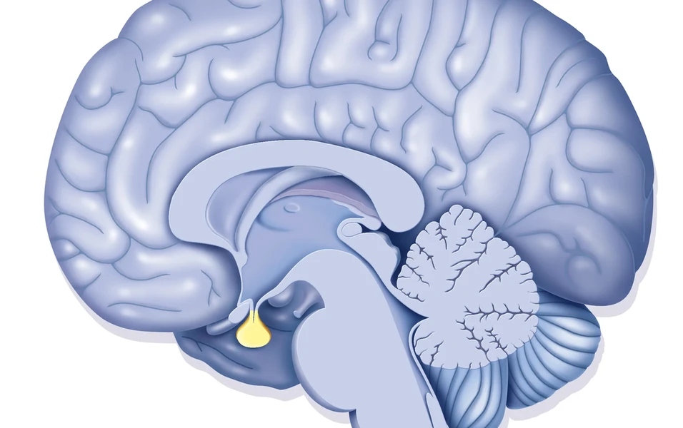 Cushing’s Syndrome decoded for everyday awareness