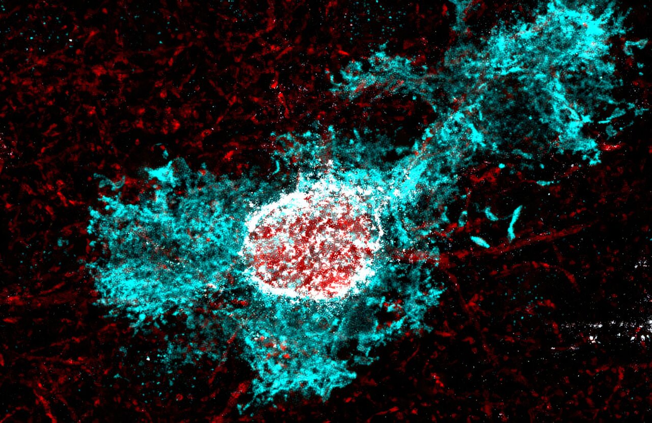 How stress hormone shapes brain development: New clues to why early ...