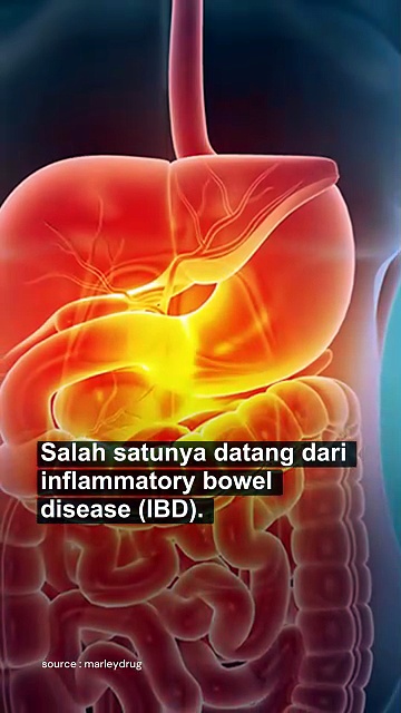 Gen Z hati-hati, pakar UI ingatkan gejala yang bisa berujung kanker ...