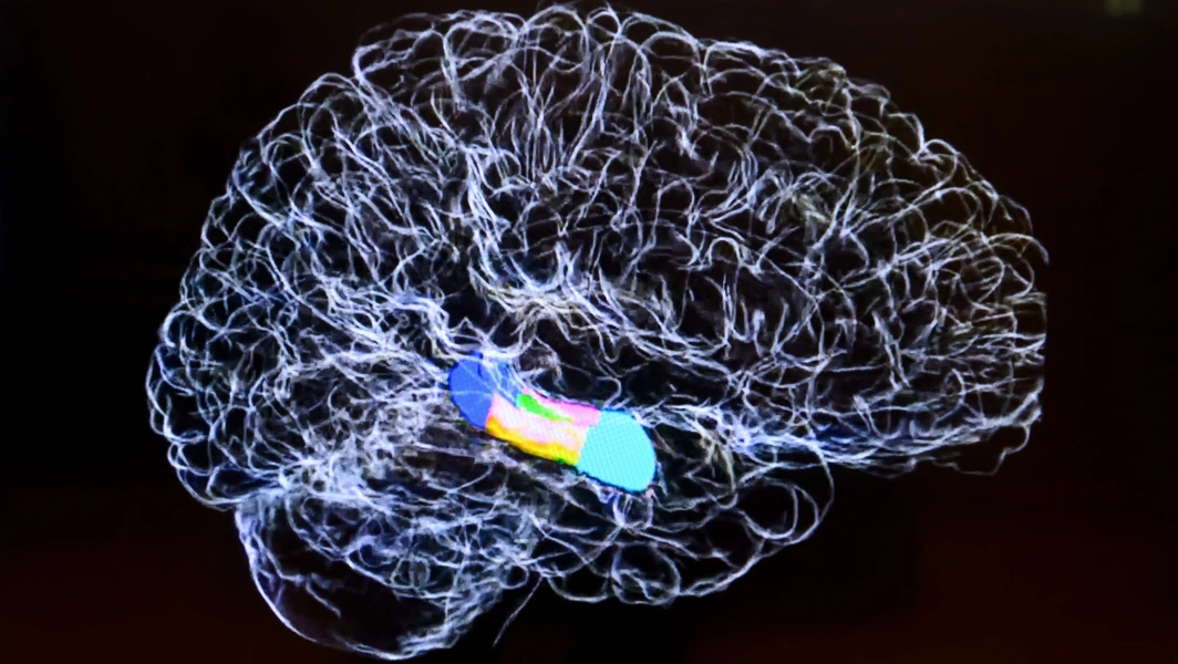 Study finds literacy rewires brain’s spoken language pathways