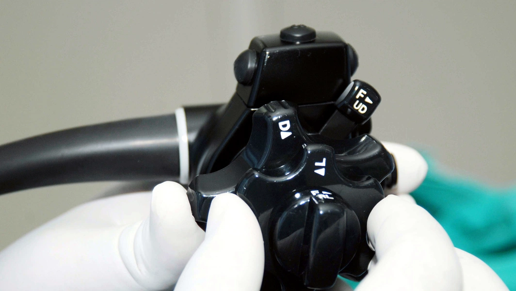 Saliva bacteria patterns show promise in early esophageal cancer detection