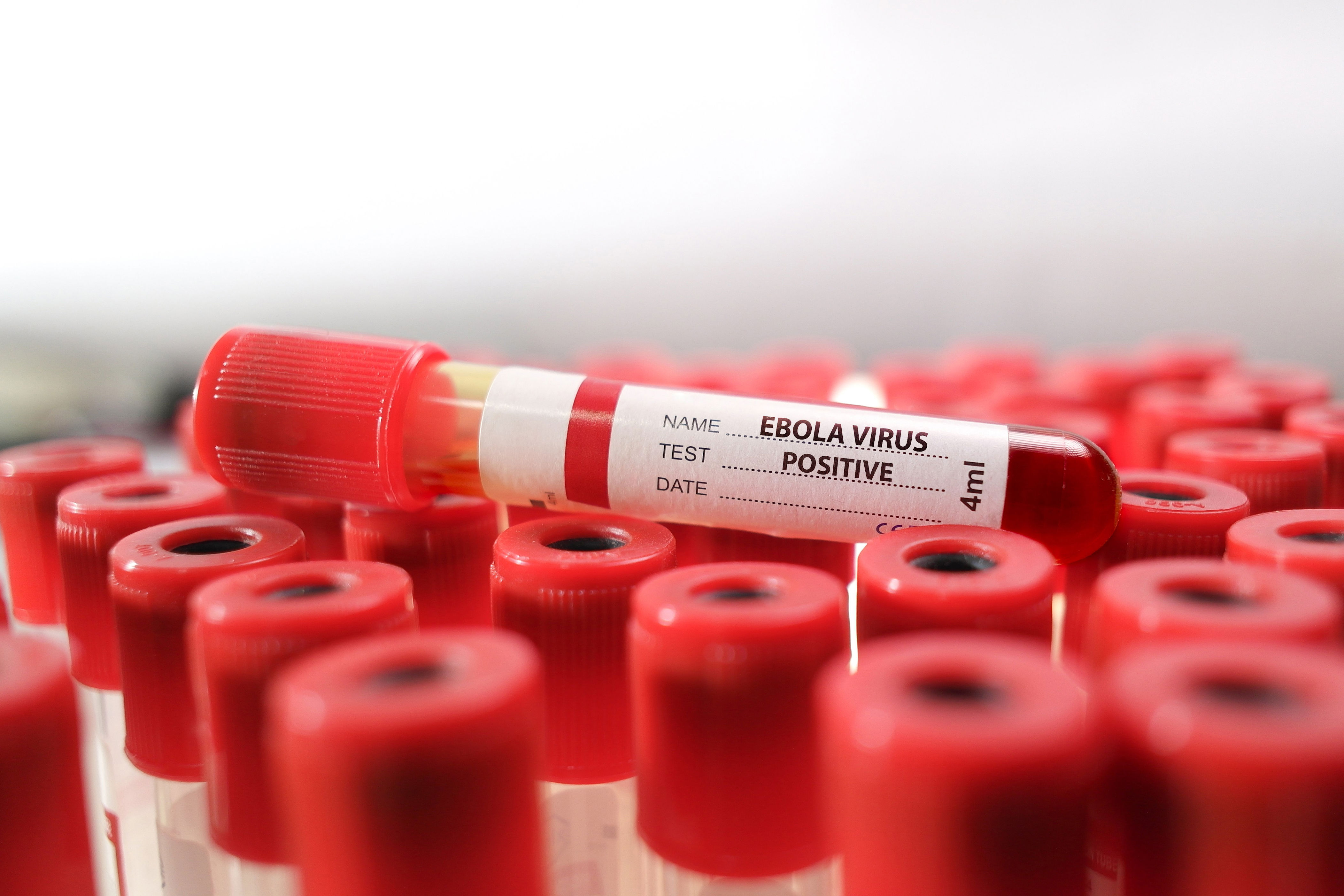 Dane WHO o epidemii eboli w Afryce. Setki zakażeń i rosnący bilans ofiar
