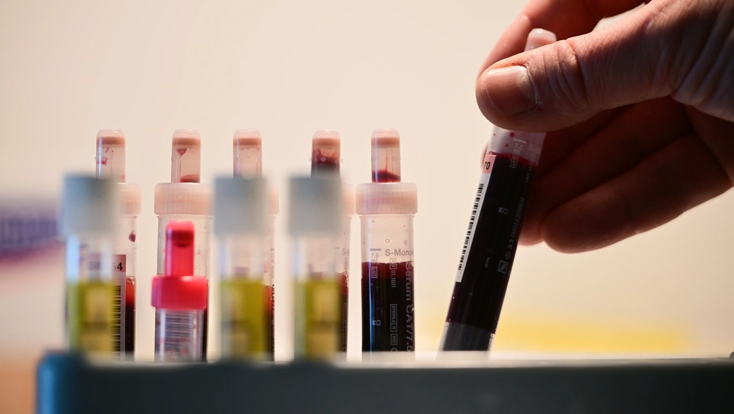 CDC flags late HIV diagnoses as older adult STD rates climb