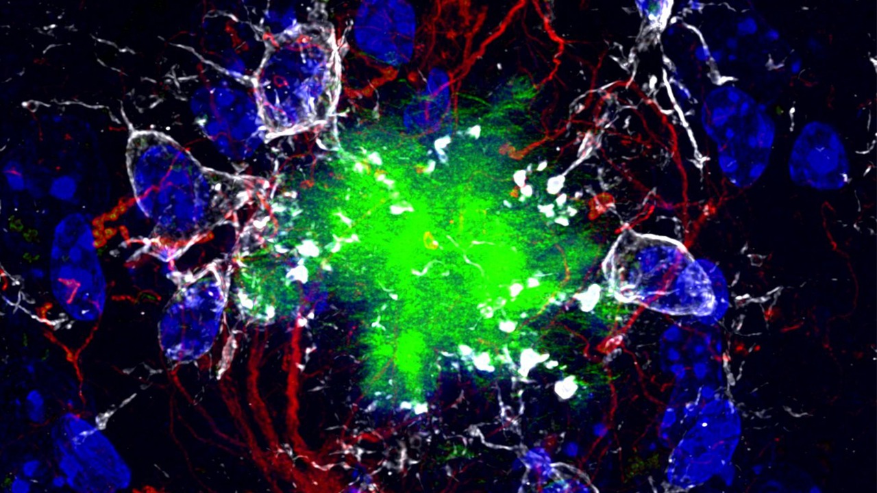 CBD may calm the brain’s runaway immune response behind Alzheimer’s ...