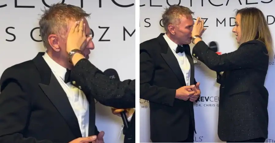 Krzysztof Gojdź zrobił sobie lifting. Dotknęliśmy jego czoła