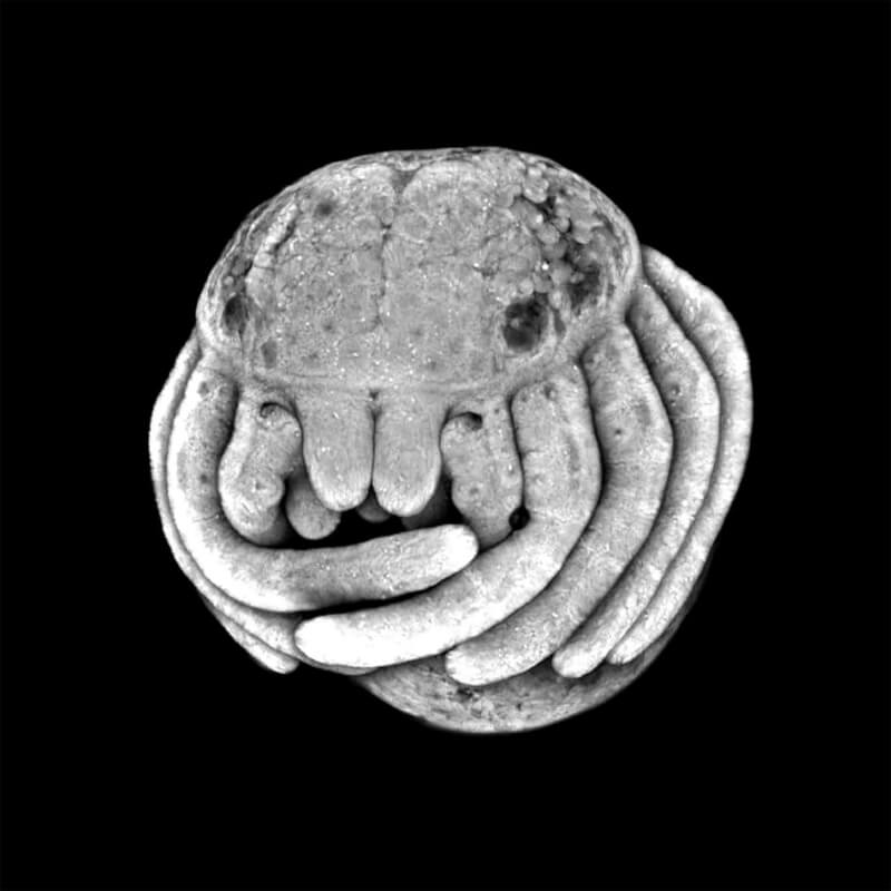 Reddit can't look away from this alien-like spider embryo inside its egg