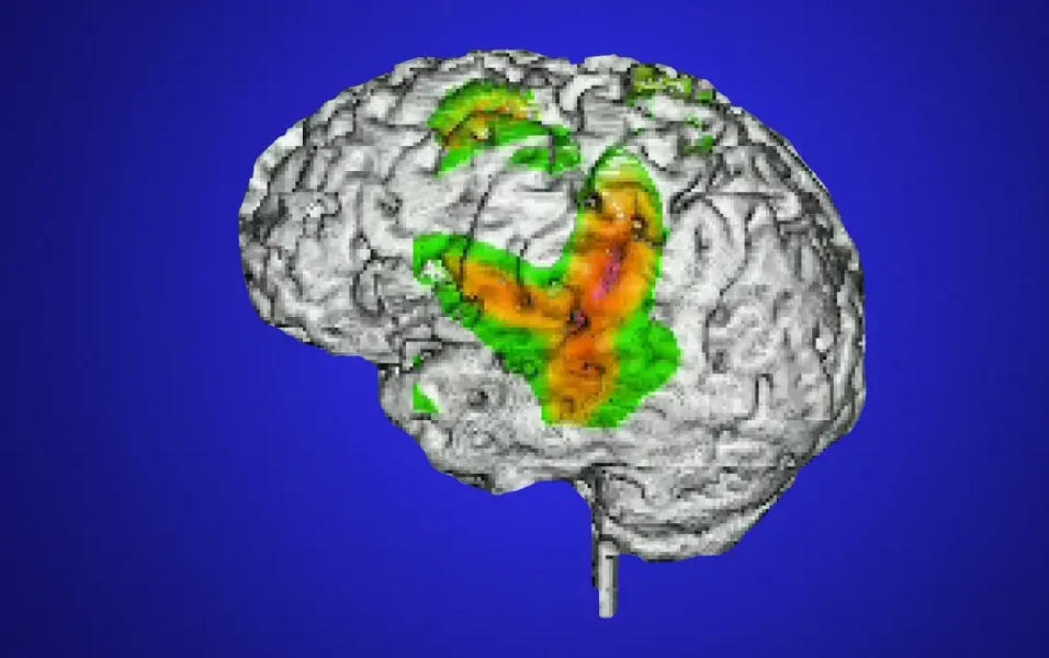 Study finds literacy rewires brain’s spoken language pathways