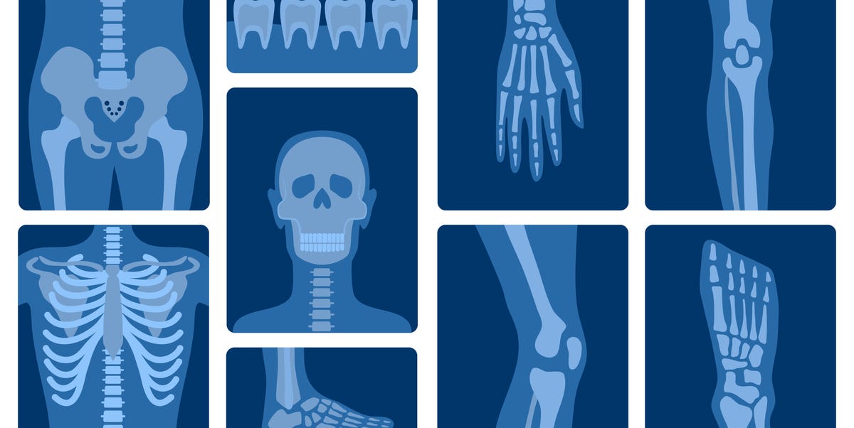 What all runners need to know about bone health