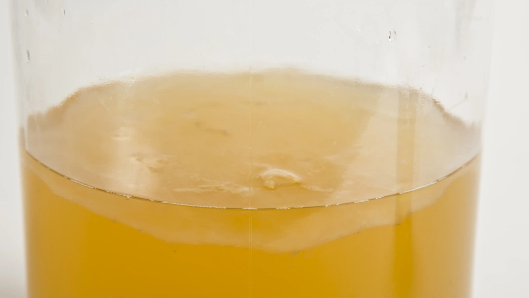 Kombucha culture from brew to boom