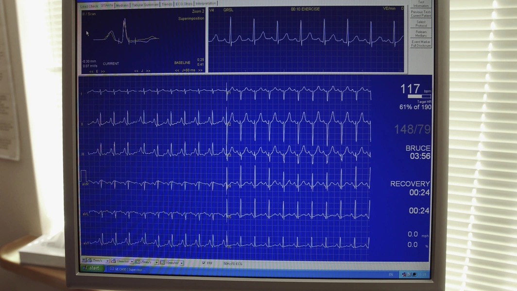 Atenolol and beta blockers made simple for your heart