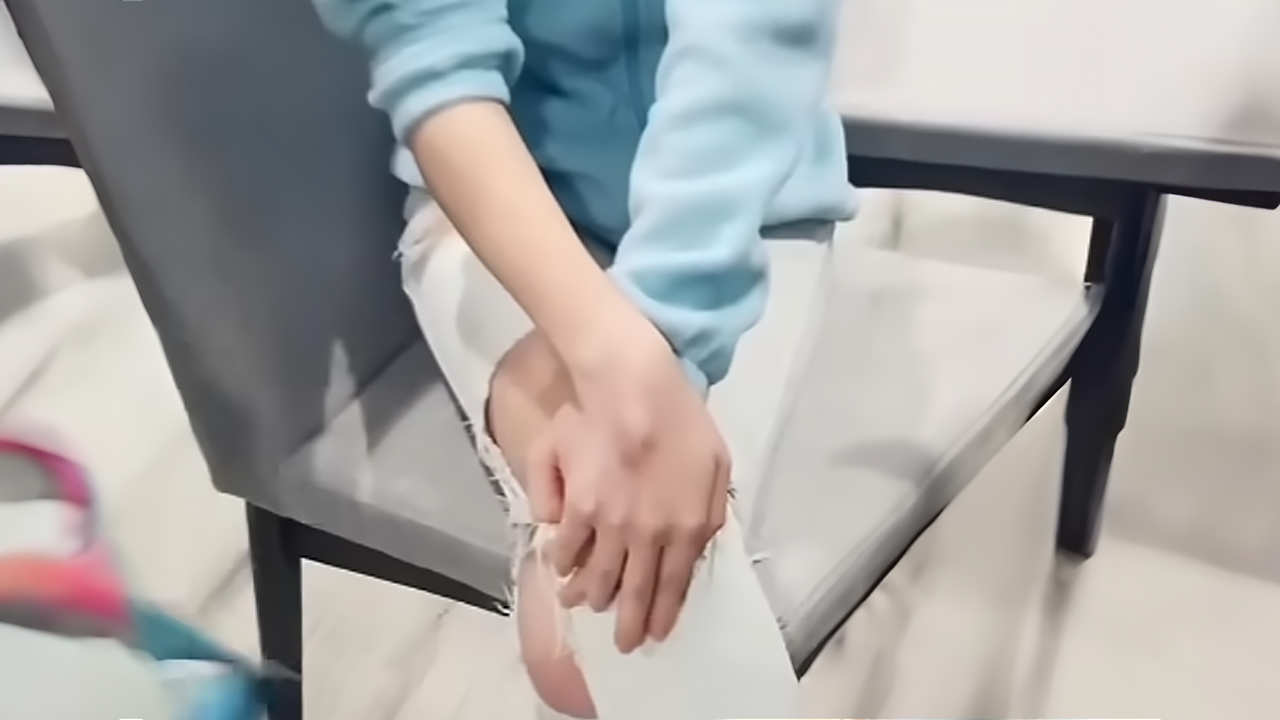Doctor reacts to cyst treatment using a book