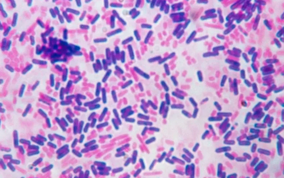 Saliva bacteria patterns show promise in early esophageal cancer detection