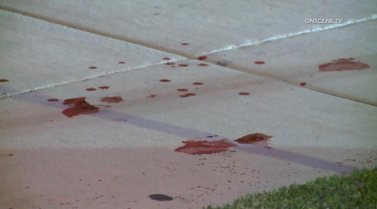 Police search for suspect in random Long Beach stabbing that injured woman
